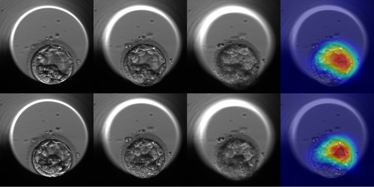 AI achieves 90% accuracy in the selection of euploid embryos - IVI UK