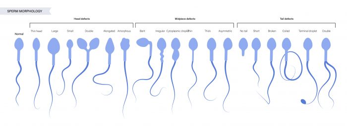 A Guide to Sperm Cells and Their Functions - IVI UK