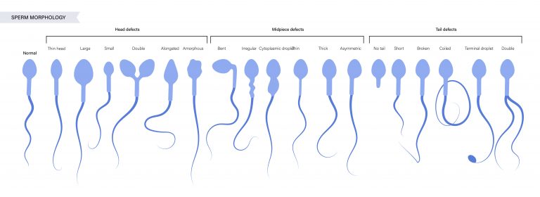 A Guide to Sperm Cells and Their Functions - IVI UK